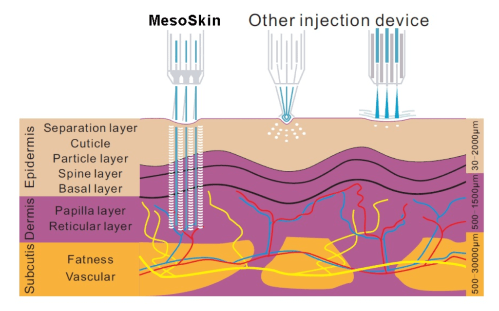 No-needle Mesotherapy - SkinRX Aesthetic Clinic PTY (LTD)