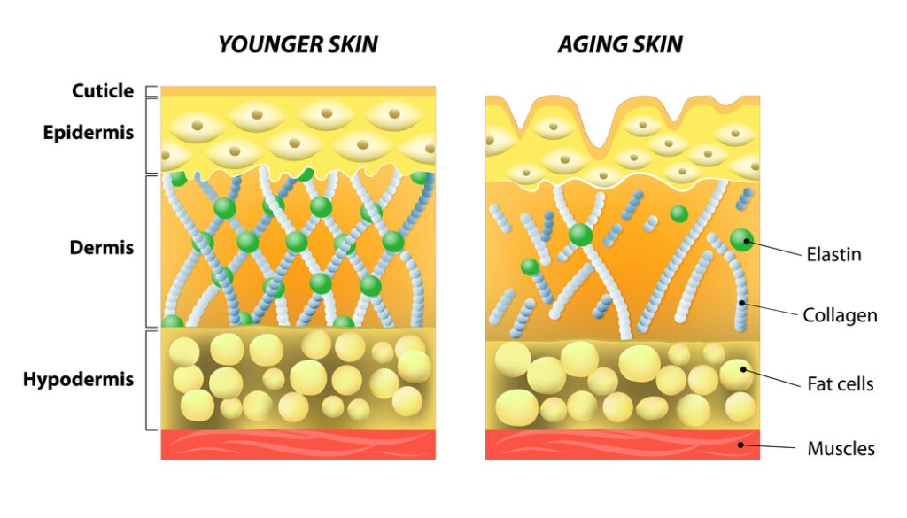 Radio Frequency - SkinRX Aesthetic Clinic PTY (LTD)