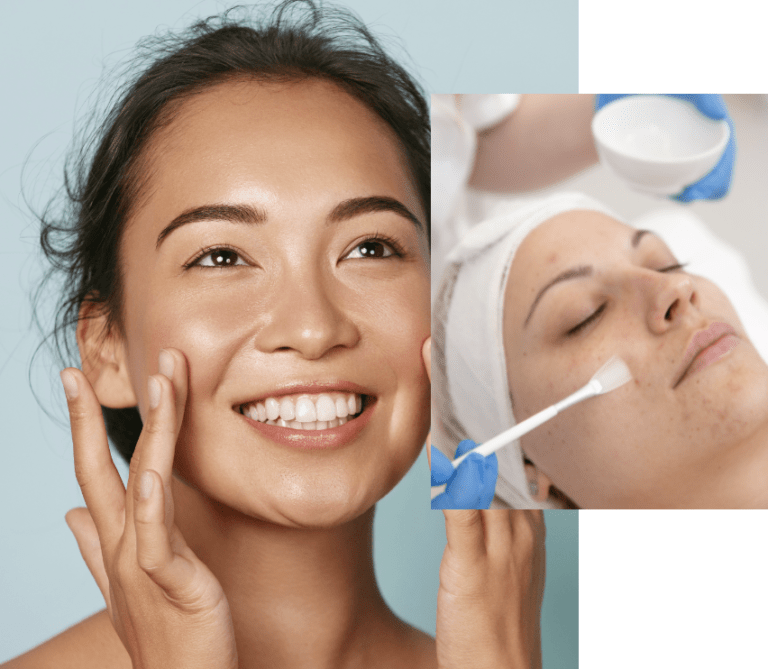 MeLine Skin Peel - SkinRX Aesthetic Clinic PTY (LTD)